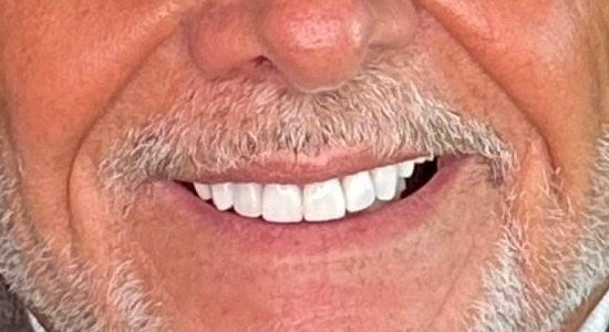 Smile Gallery - Dentist in Nyack, NY | Dwayne M. Bodie, DMD PC